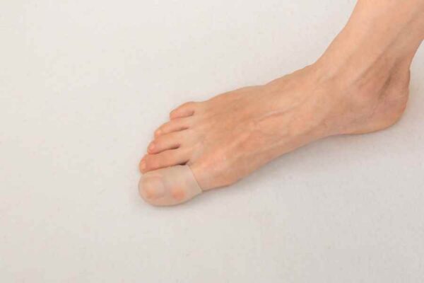 Tipos y tratamientos de los callos en los dedos de los pies