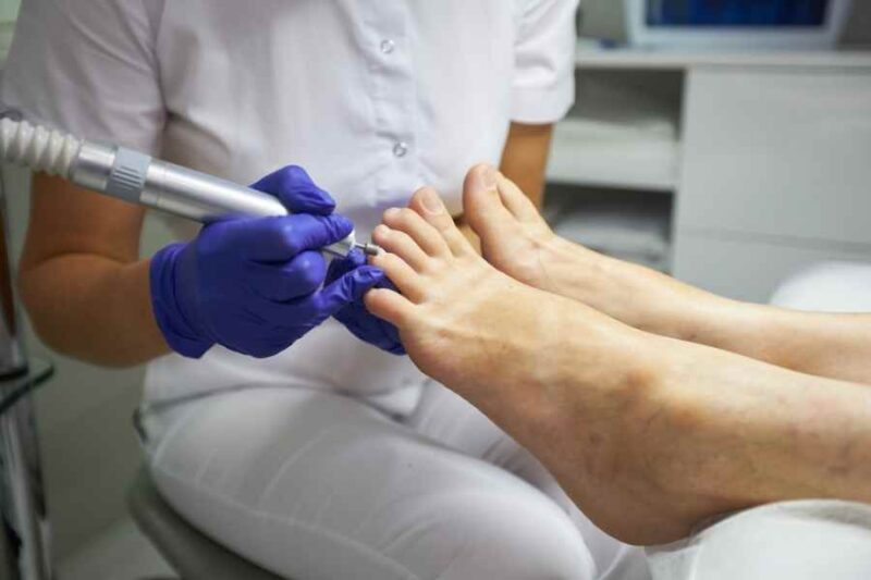 Tipos y tratamientos de los callos en los dedos de los pies